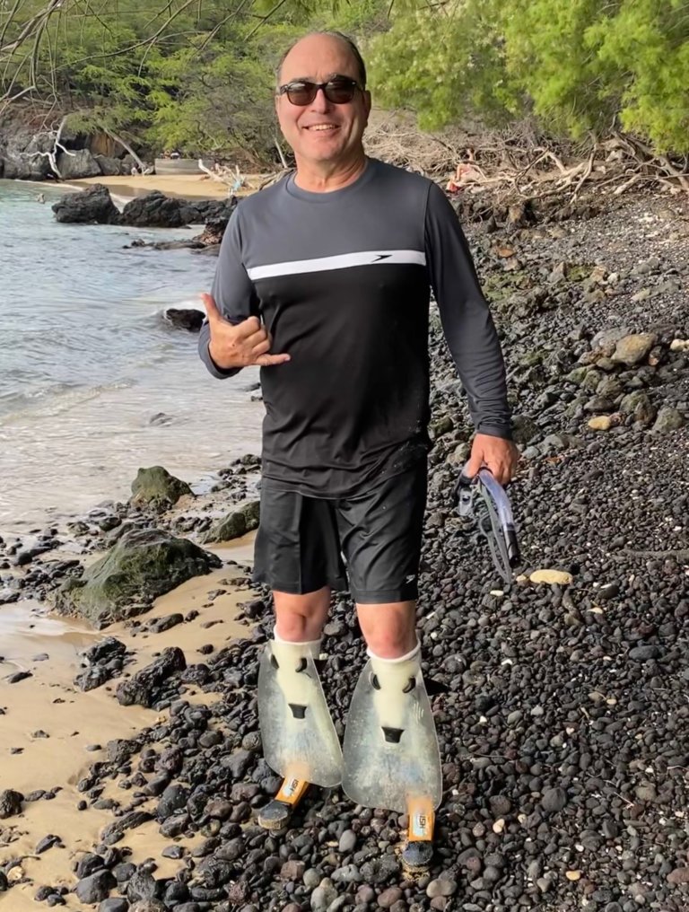 Osseointegration below knee amputations: snorkeling fins - shinfin™ leg ...