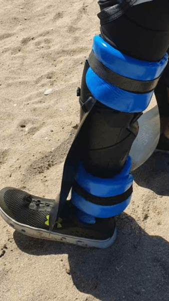 Above knee amputation fins. Fit stumps - shinfin™ leg fins